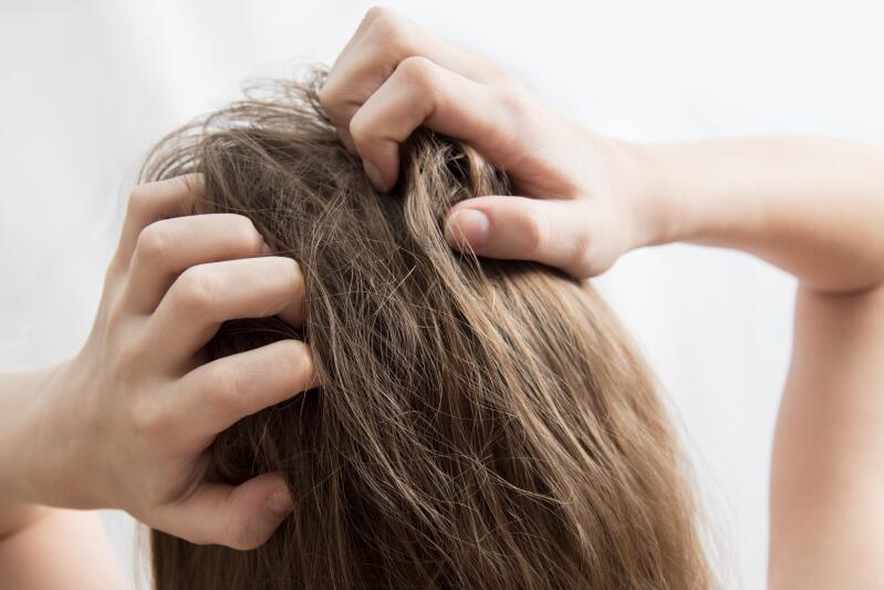 Scalp dysesthesia: how do I get scalp relief? | Ducray Laboratories