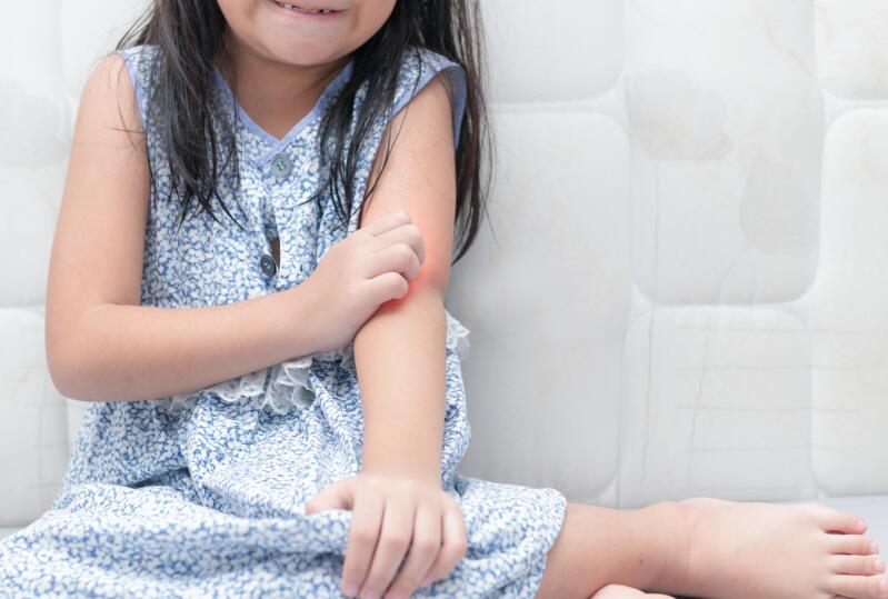 Le psoriasis chez l’enfant | Ducray