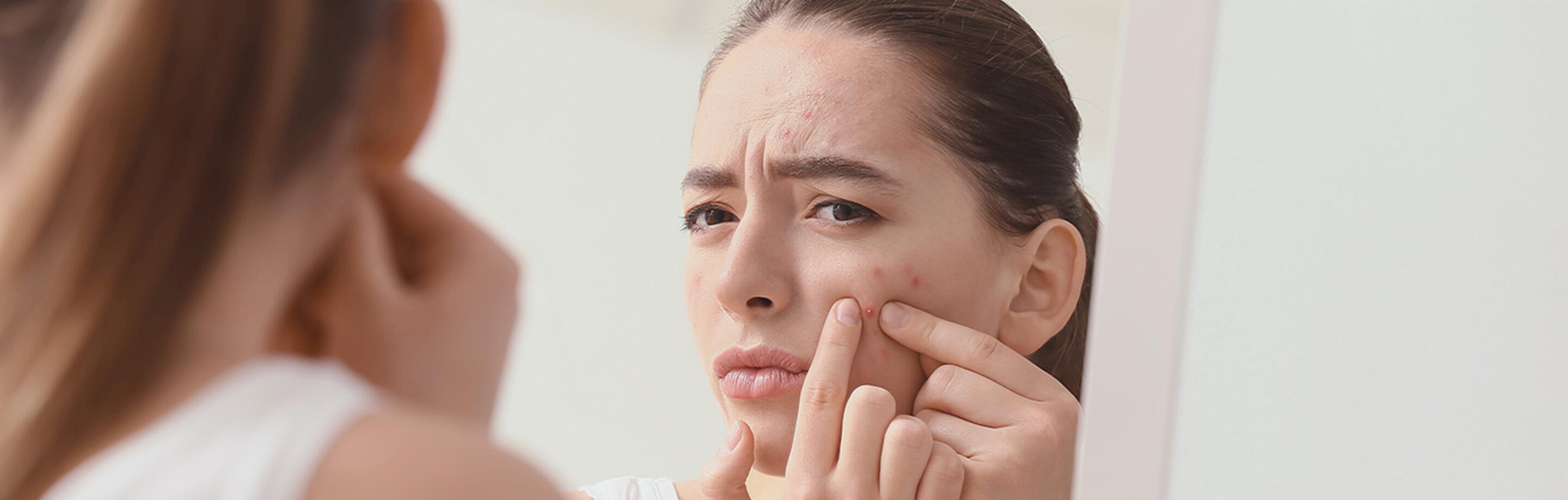 Die verschiedenen Akne Arten | Eau Thermale Avène