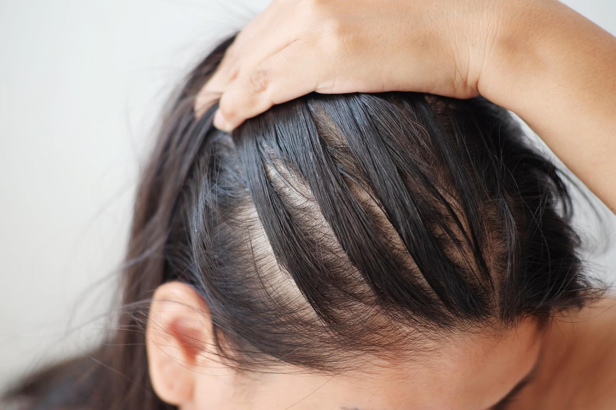 Nuestros consejos para cuidar el cuero cabelludo de forma natural