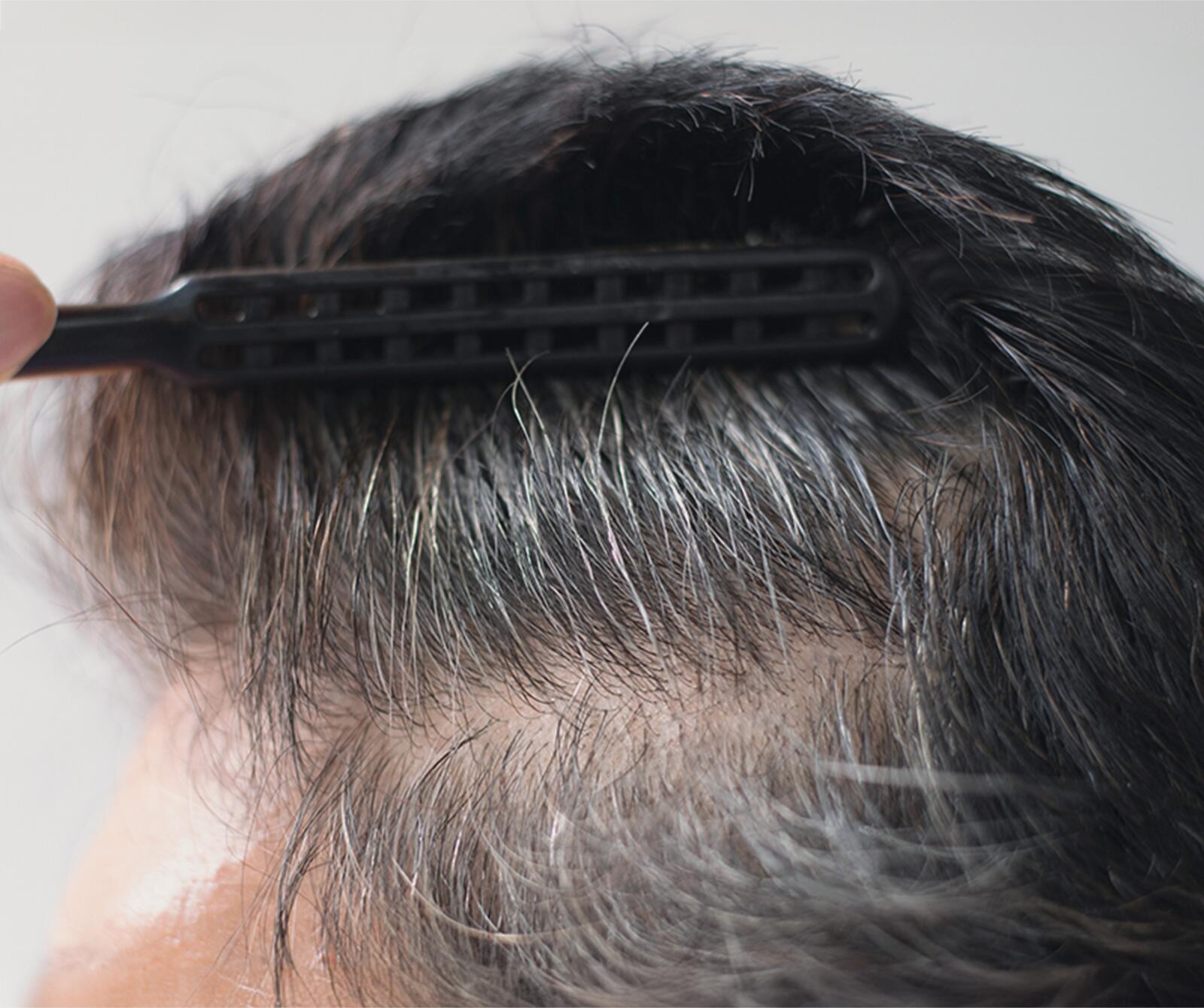 Haarausfall in den Wechseljahren | Ducray