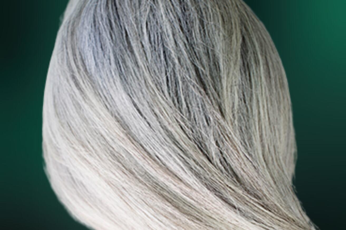 Alopecia androgénica, pelo ralo: ¿cómo cuidar tu cabello?