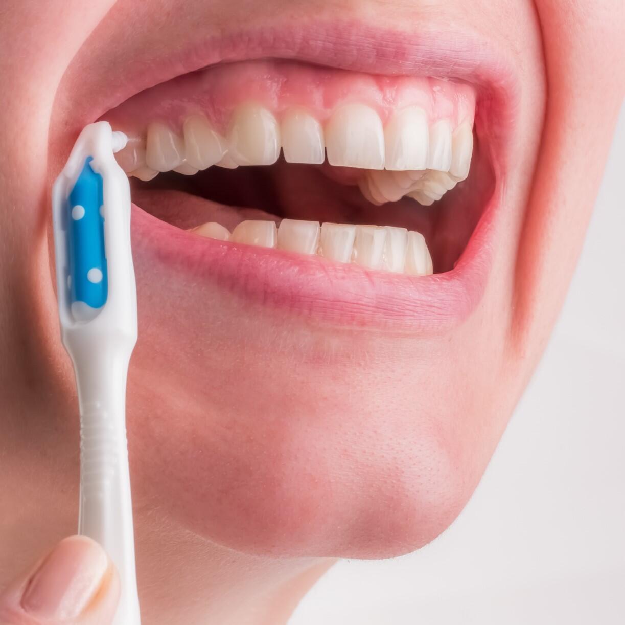 Aften op de tong: oorzaken, symptomen en behandelingen | Oral Care