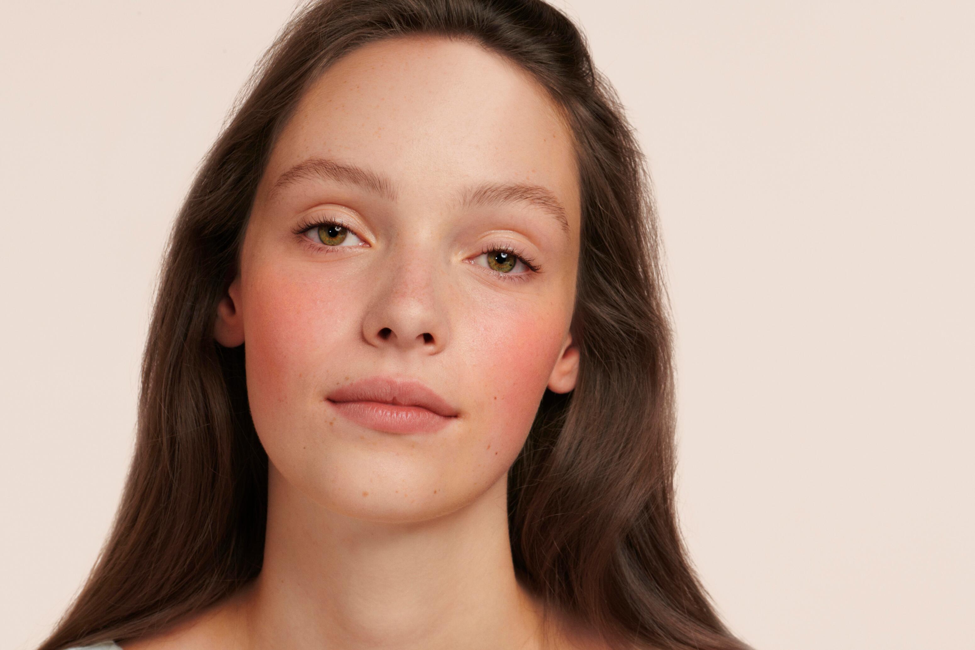 Akne-Arten erkennen und verstehen | Eau Thermale Avène