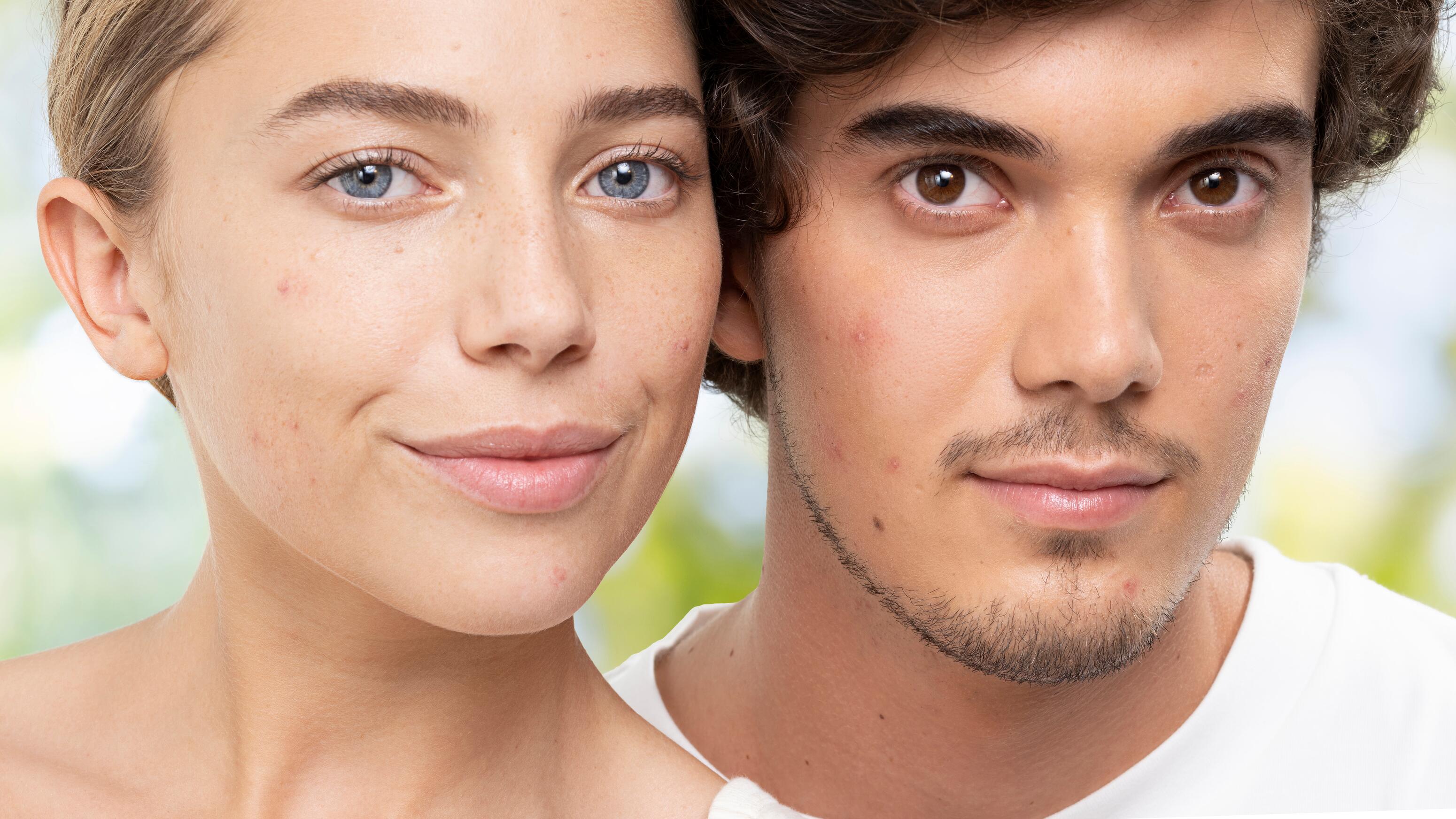 A-DERMA : La Marque de Soins pour Peau Fragile