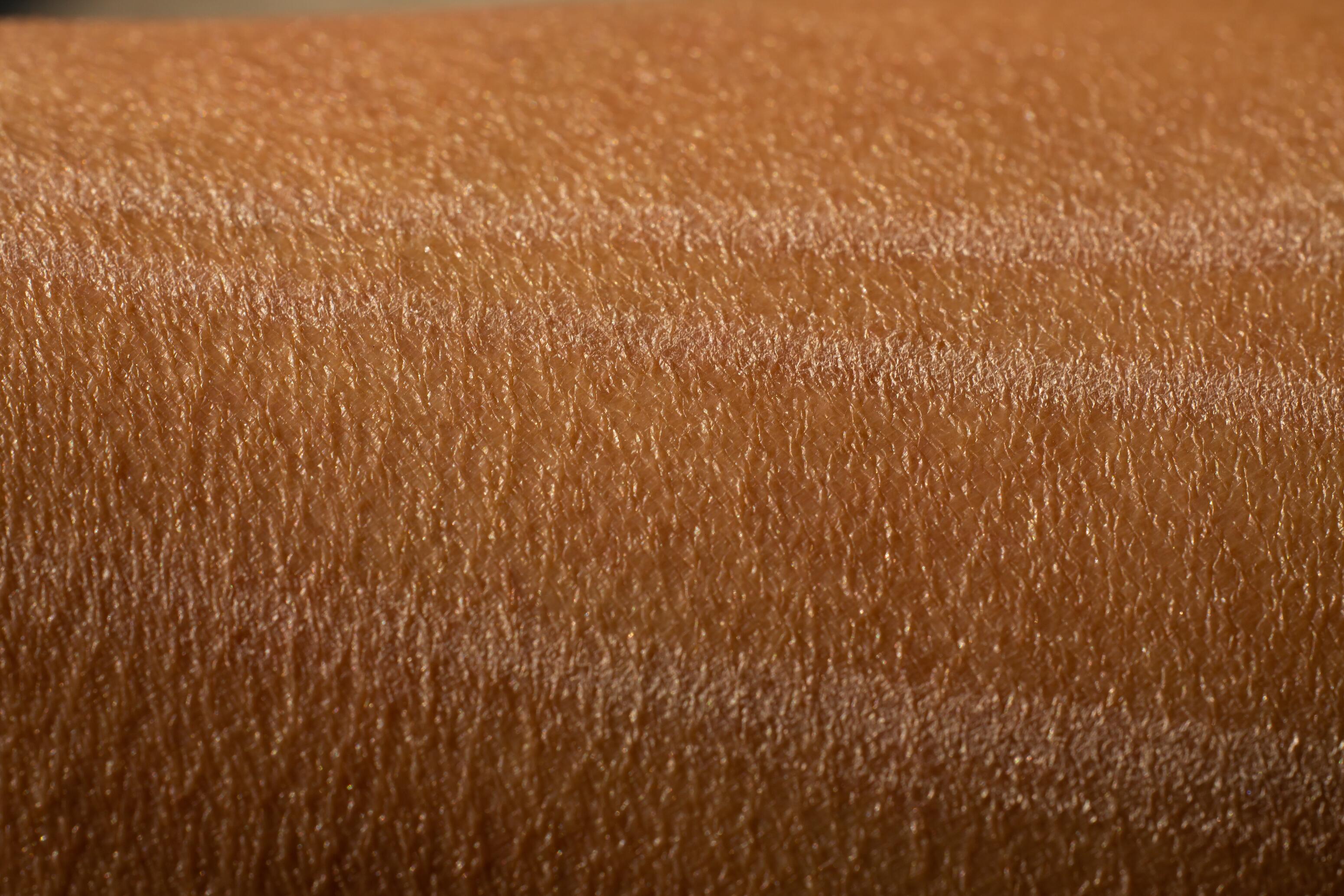 Relieving Tight Skin: A Complete Guide